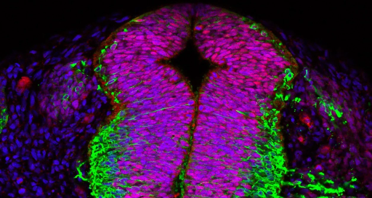 Neural Development — HDBI - Human Development Biology Initiative