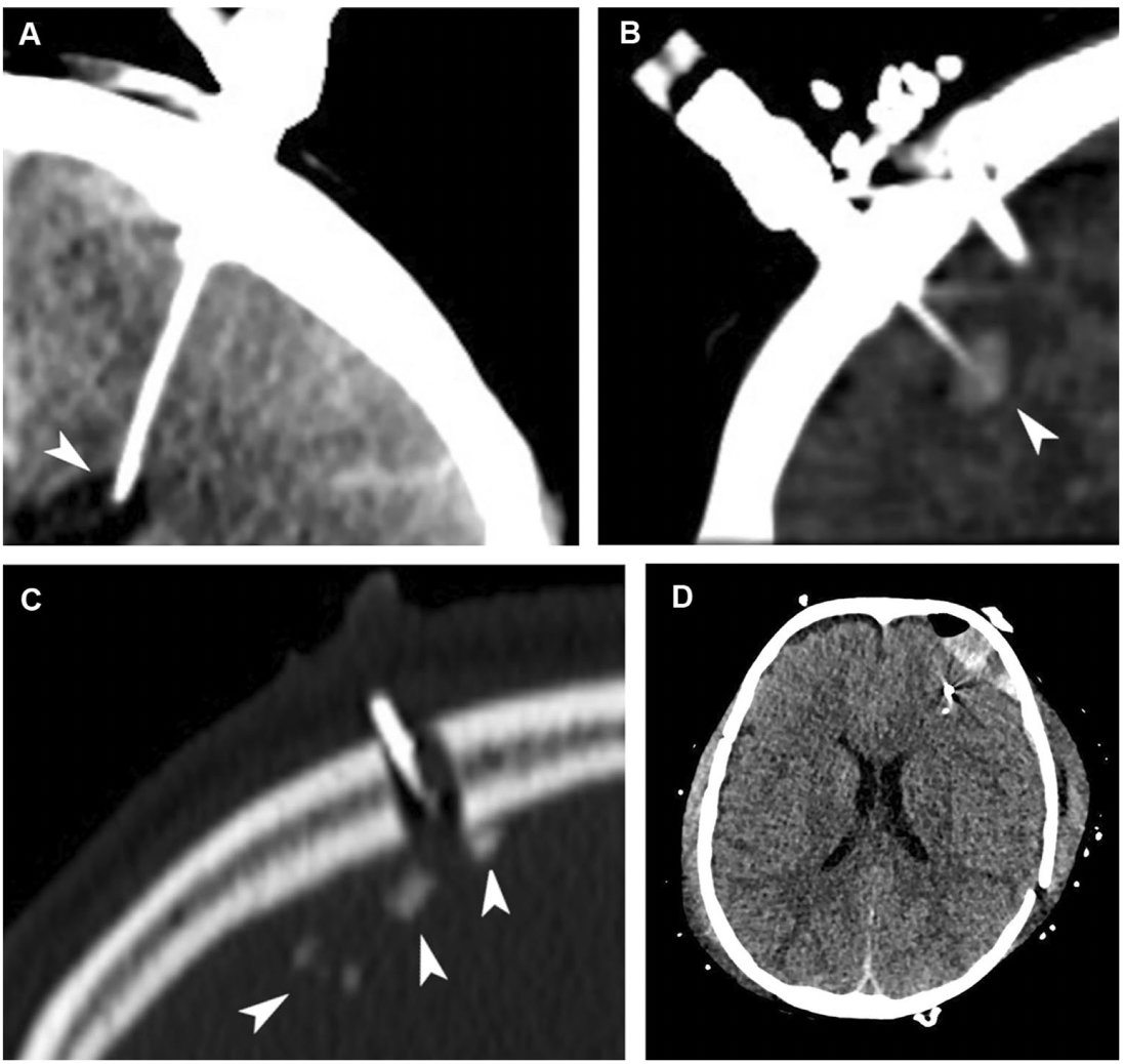Neurocore — Sciense