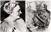 Spontaneous Human Combustion
