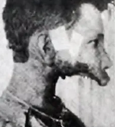 Eben Byers: The Man Whose Jaw Fell Off