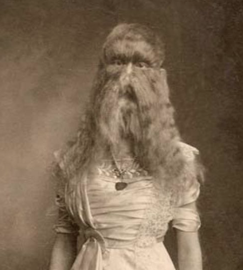 Alice Elizabeth Doherty: The Minnesota Woolly Girl