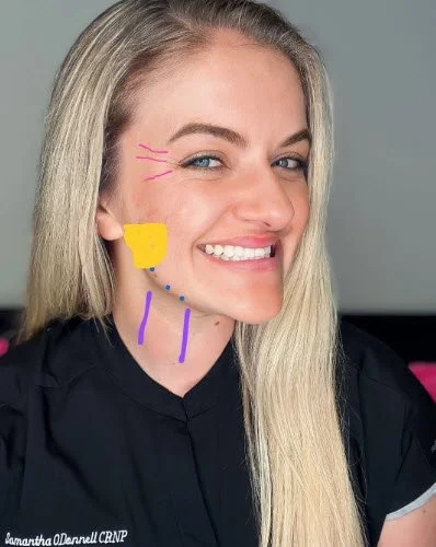 Exploring The Cost Of Botox & Treatment Options — Dr. Charlie Seltzer