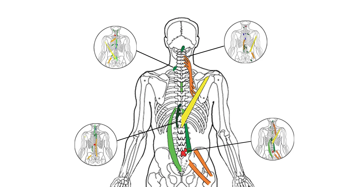 The One Solution to Pain Management Every Practice Is Missing — Spinal ...