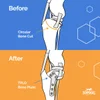Resurgence Veterinary Mobility — Unlocking Mobility: The Journey to ...