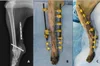 Resurgence Veterinary Mobility — Understanding Calcaneal Tendon ...