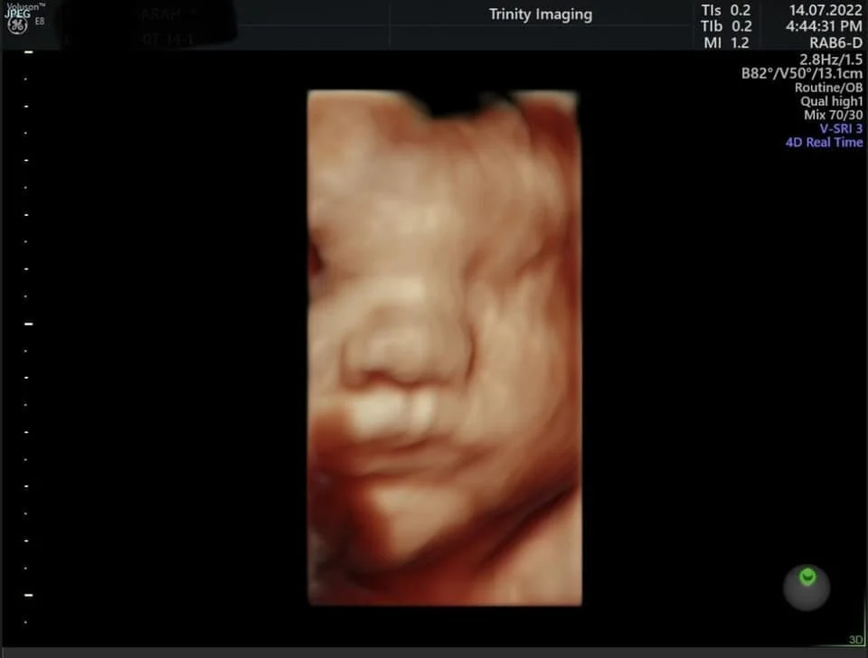 3D/4D Scan Gallery — Trinity Imaging