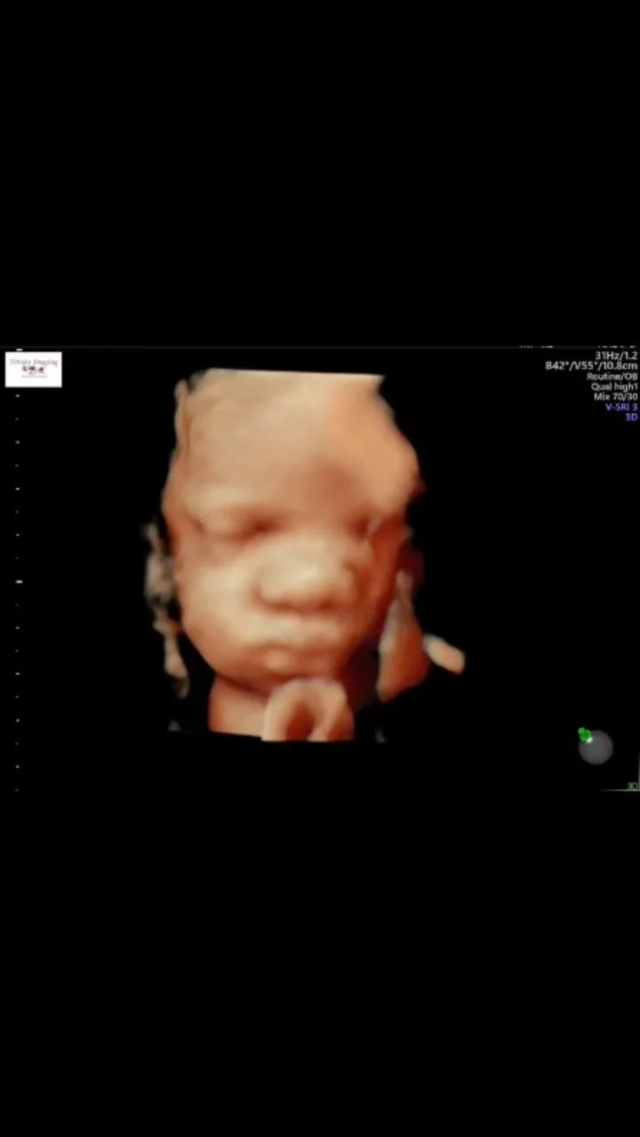 3D/4D Scans — Trinity Imaging