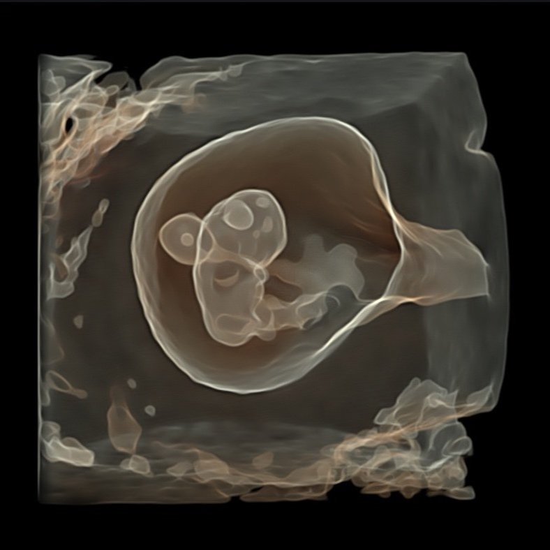 Dating Scans — Trinity Imaging