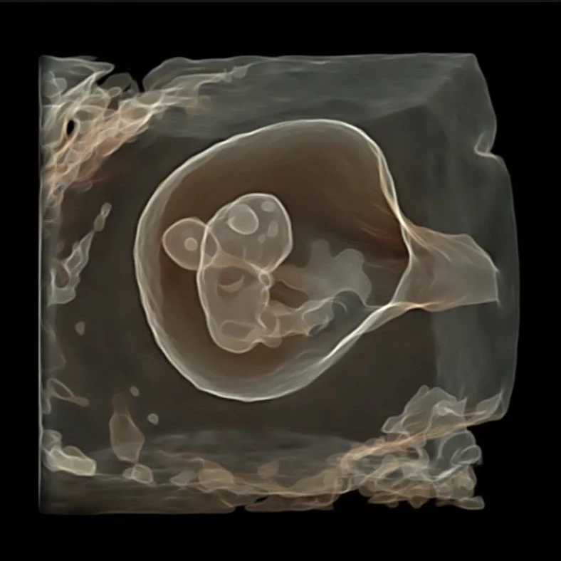 Dating Scans — Trinity Imaging