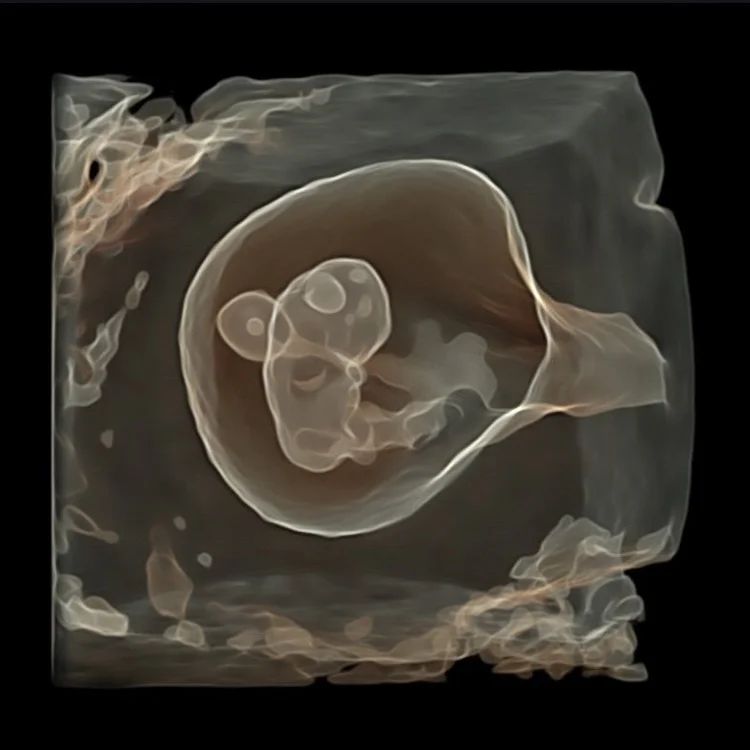 Dating Scans — Trinity Imaging