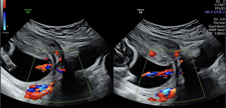 Early Anatomy Scans — Trinity Imaging