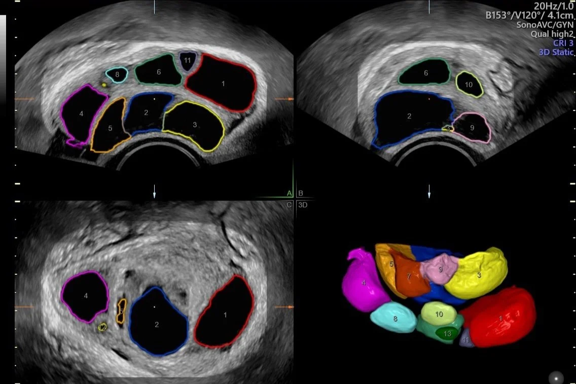 Follicle Tracking Scans — Trinity Imaging