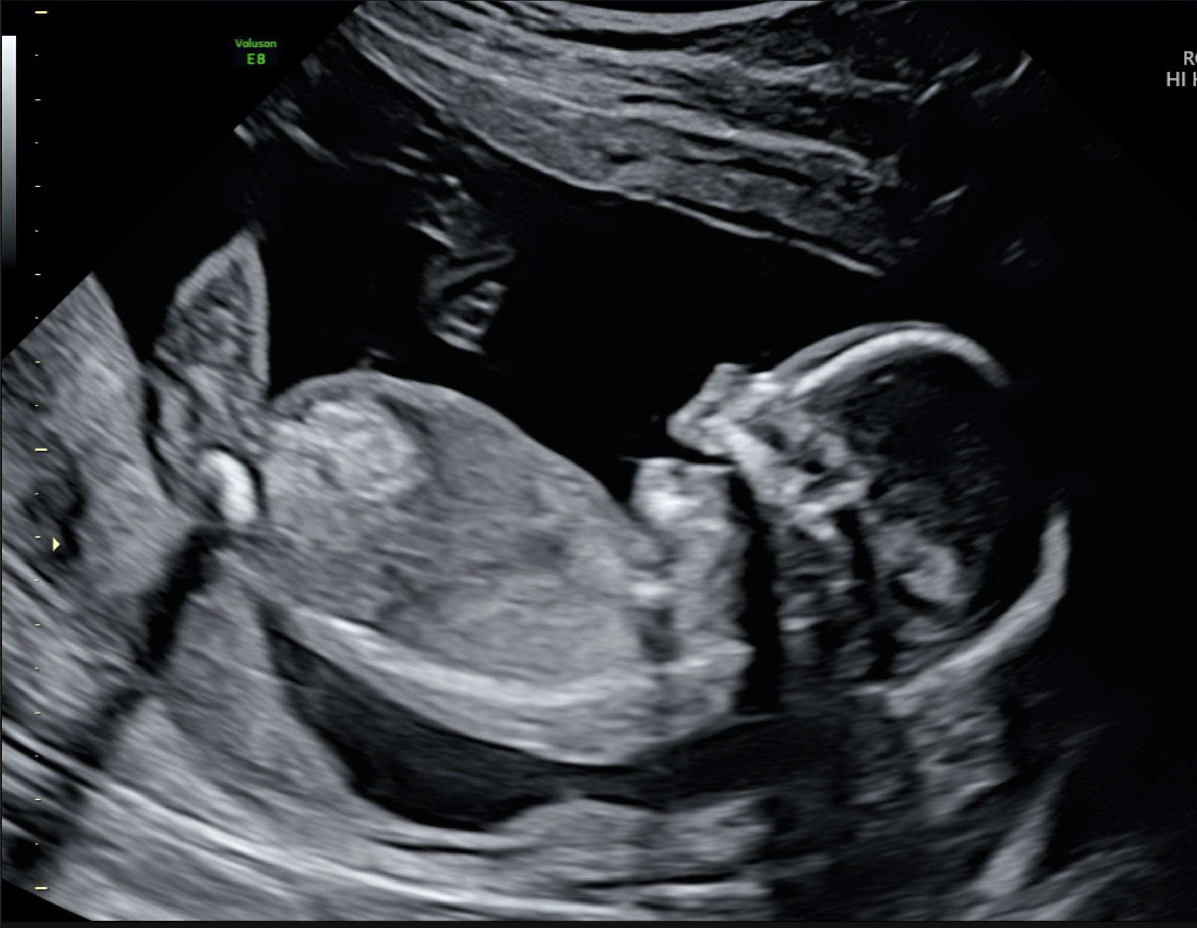 Trinity Imaging