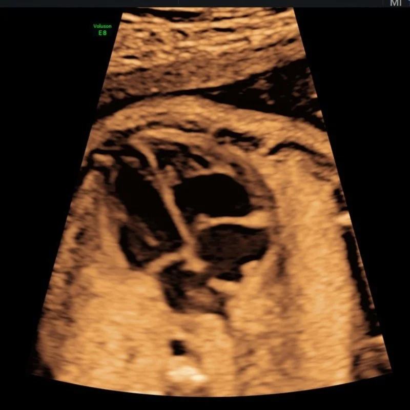 Morphology Scans — Trinity Imaging