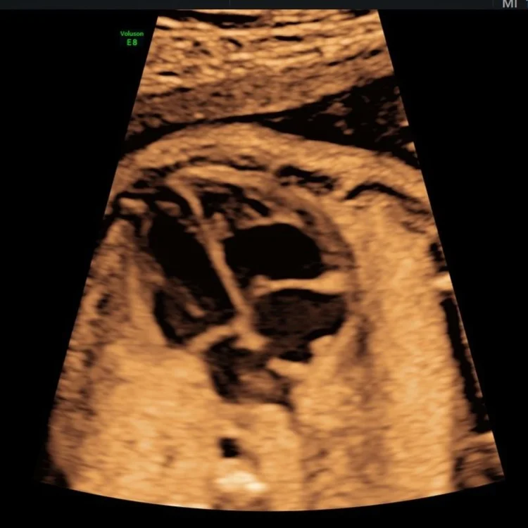 Morphology Scans — Trinity Imaging