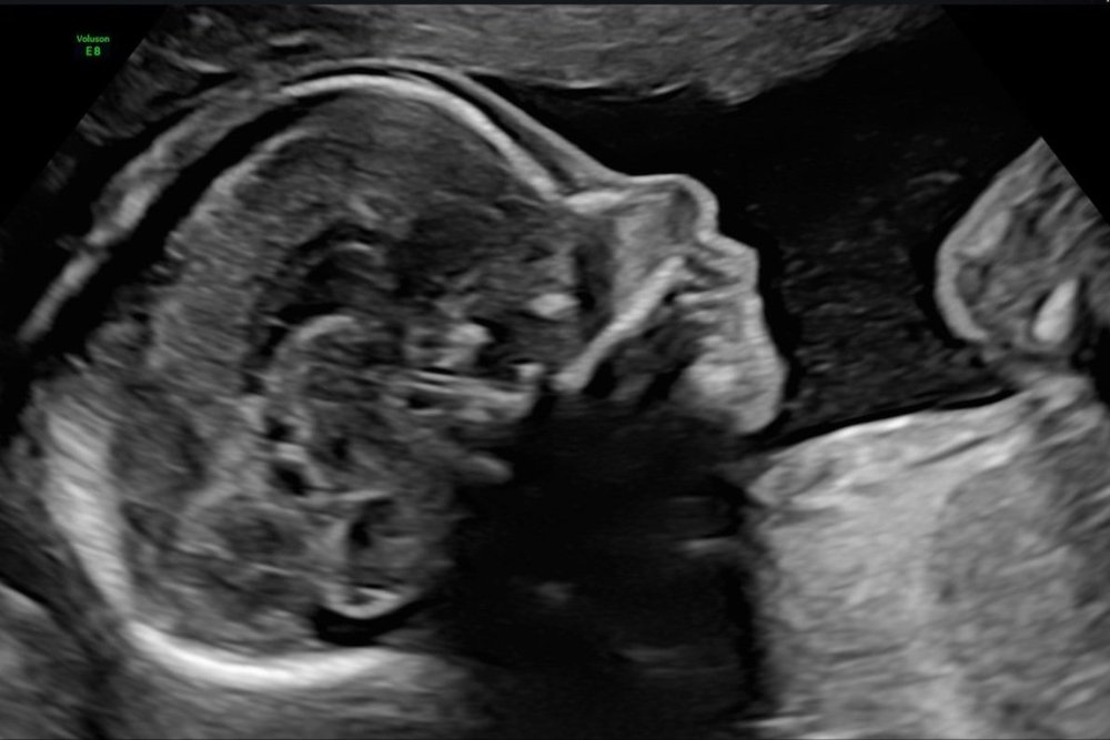 Morphology Scans — Trinity Imaging