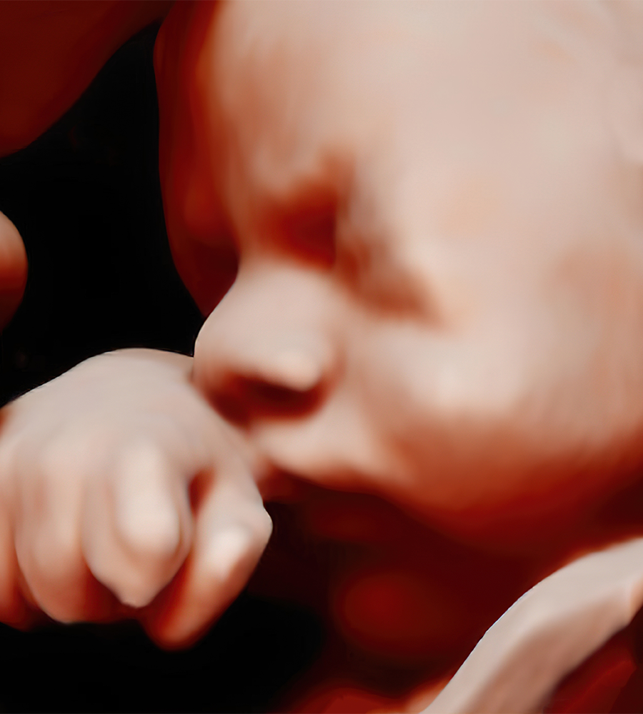 3D/4D Scans — Trinity Imaging