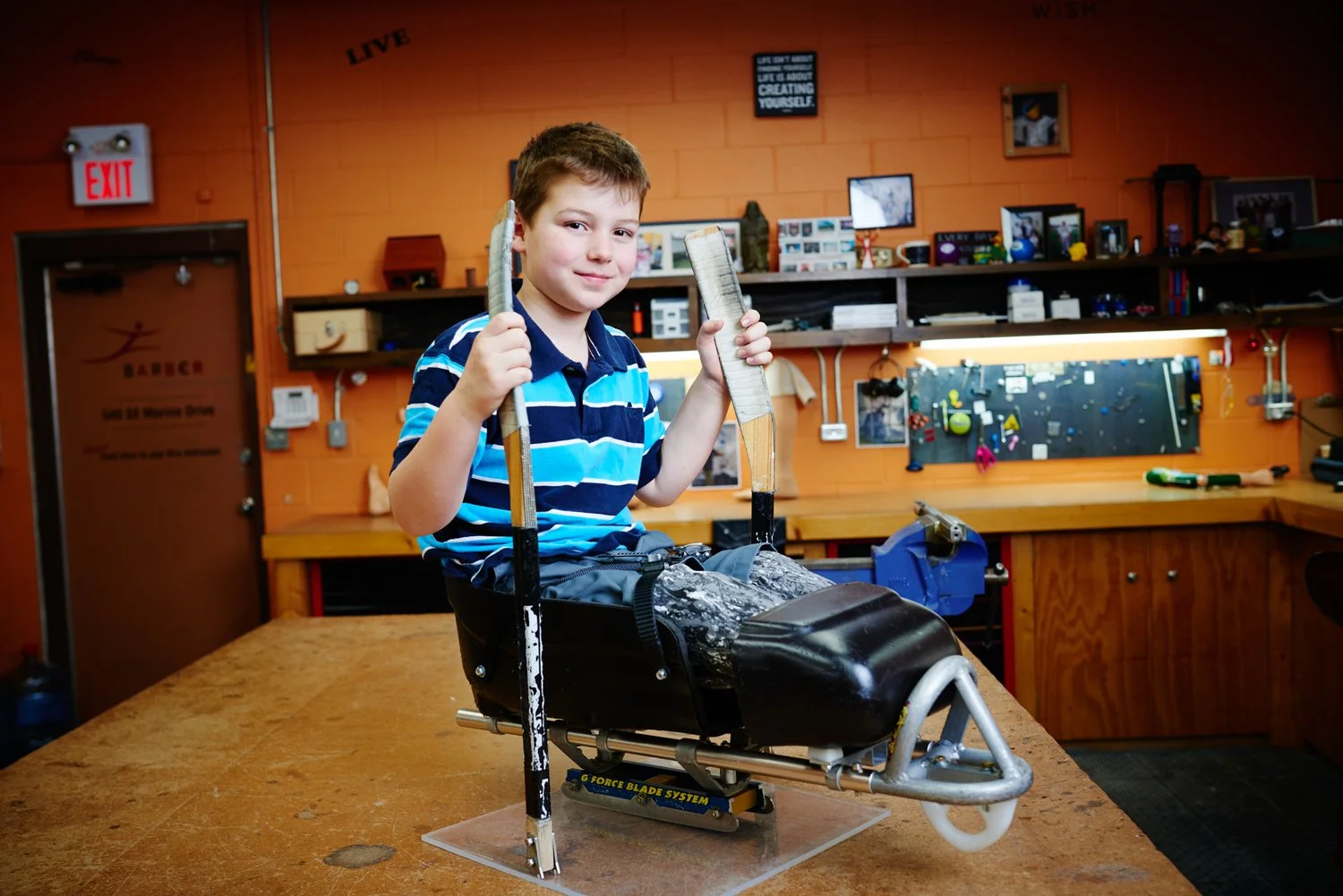 Blog 2 — Barber Prosthetics Clinic