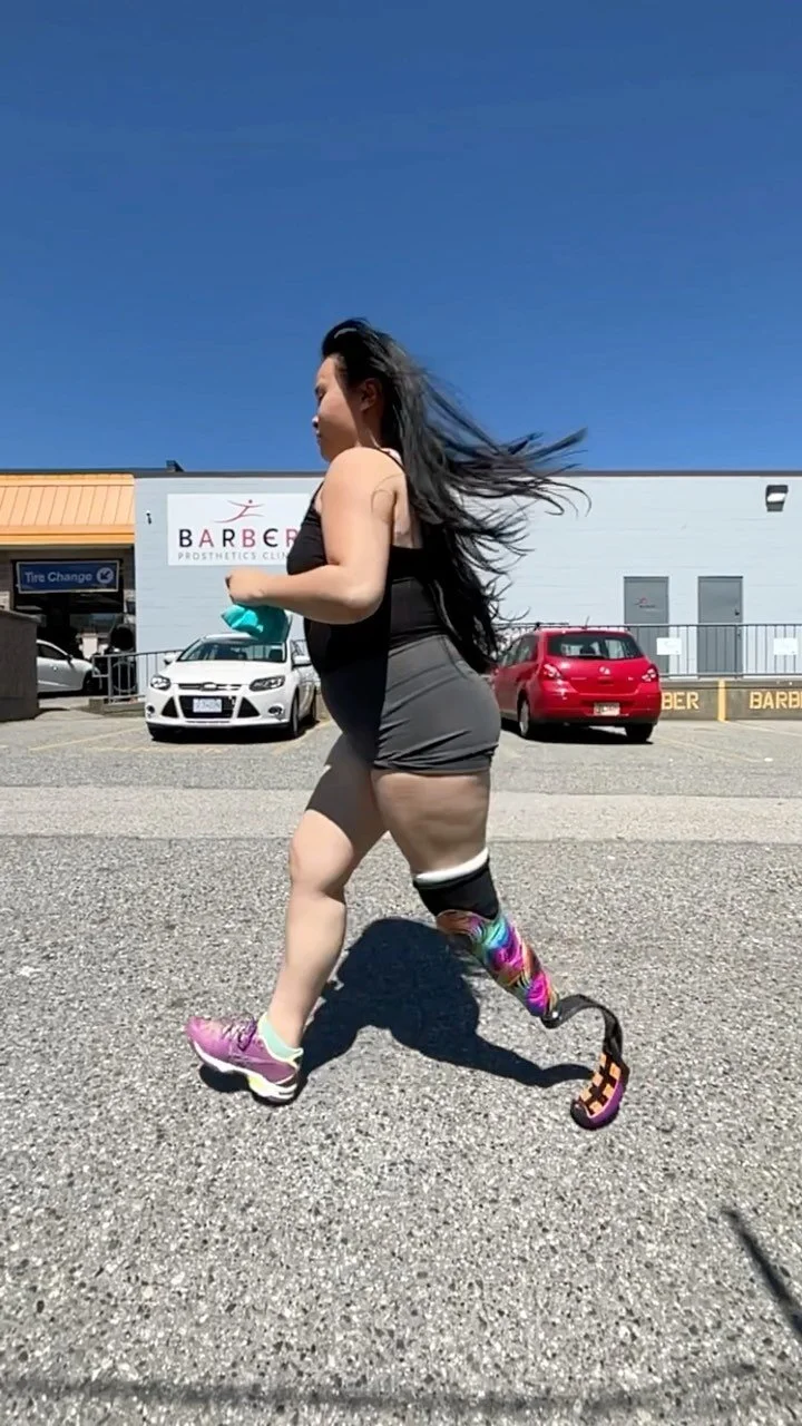 Thea — Barber Prosthetics Clinic