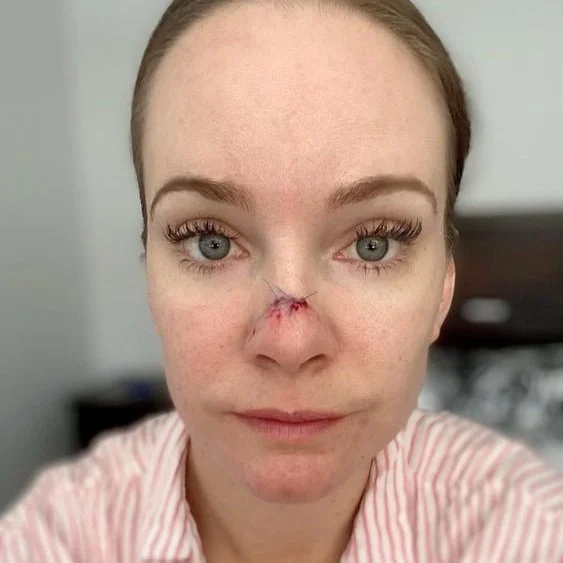 Australian Skin Cancer Foundation