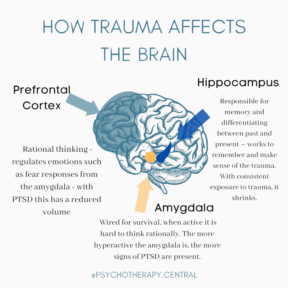 Understanding the Impact of Trauma on the Brain, Body, and Emotions ...