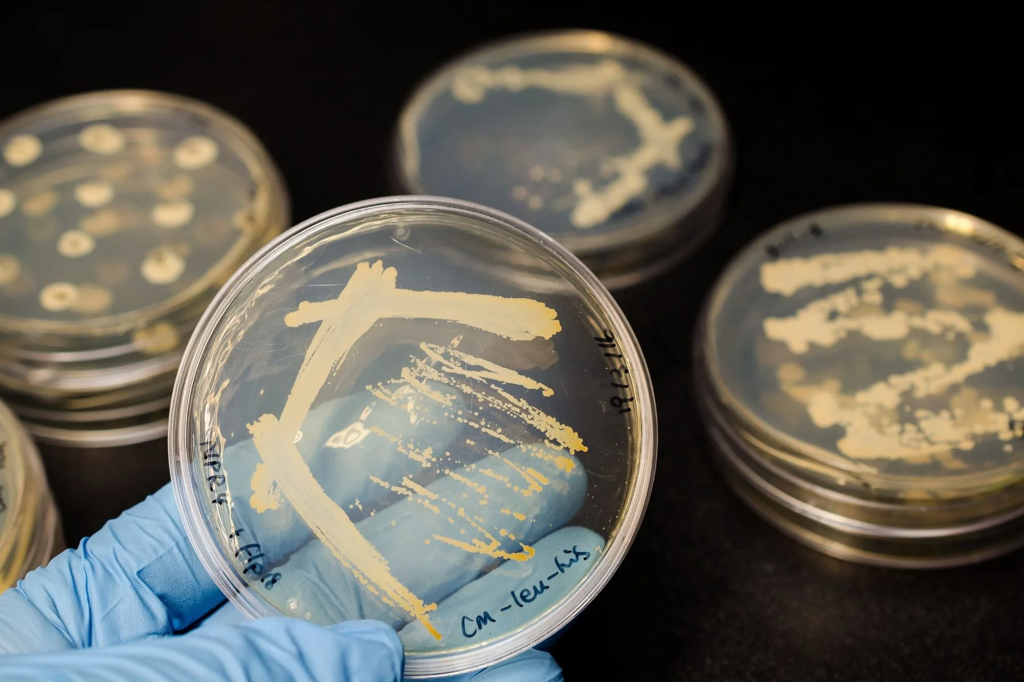 E Coli Streak Plate