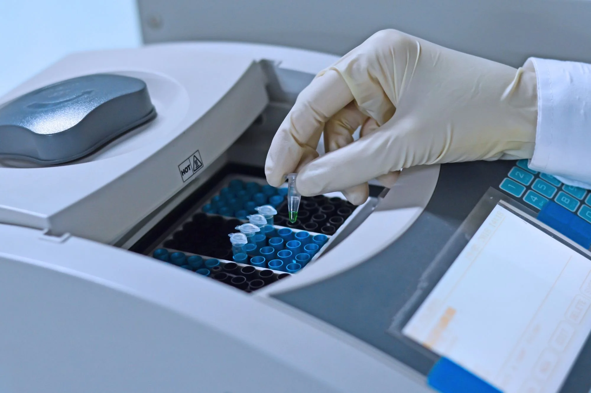 Why Your Lab E. coli Results Are Lying to You — Kraken Sense