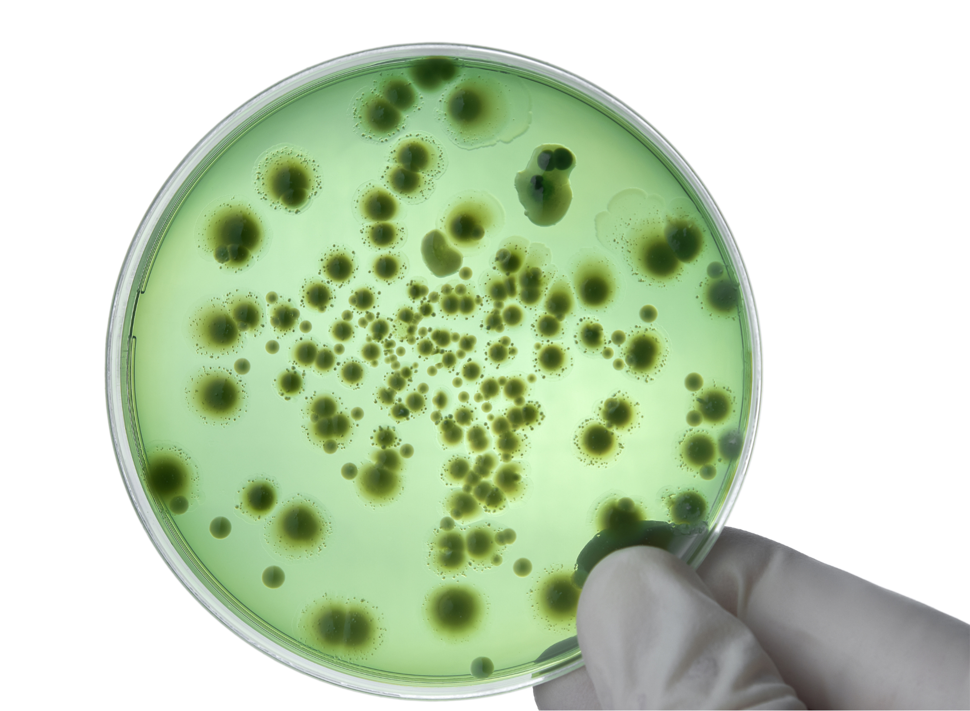 Viable But Non-Culturable (VBNC) Bacteria: Threats and Solutions