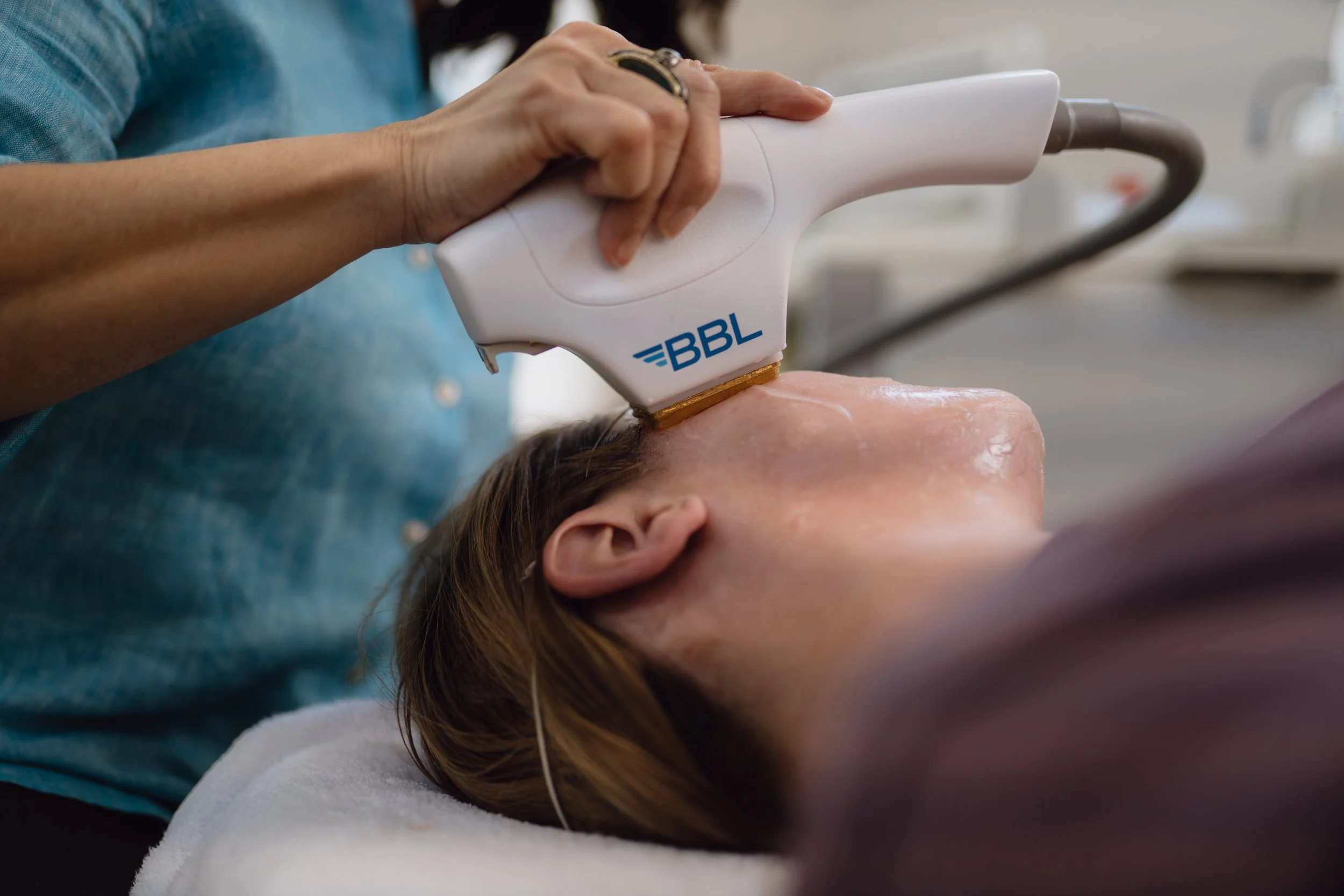 Forever Young BBL in Kerrville, Texas — O Young MD