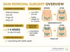 Unveiling Skin Removal Surgery: A Comprehensive Guide — MD Body & Med Spa