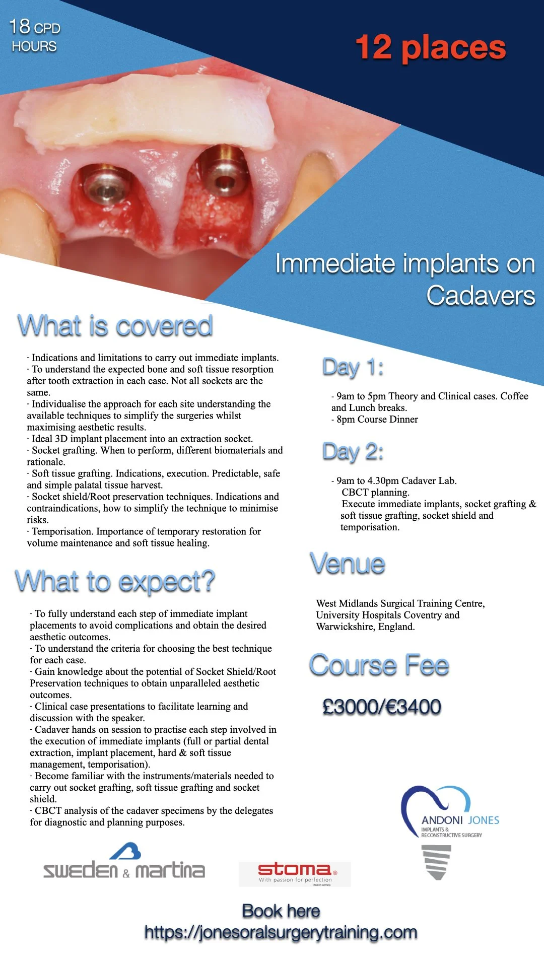 CADAVER COURSE ON IMMEDIATE IMPLANTS — Jonesoralsurgery
