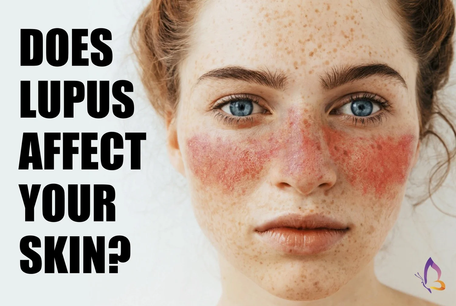 Participate in a Clinical Trial — Michigan Lupus Foundation