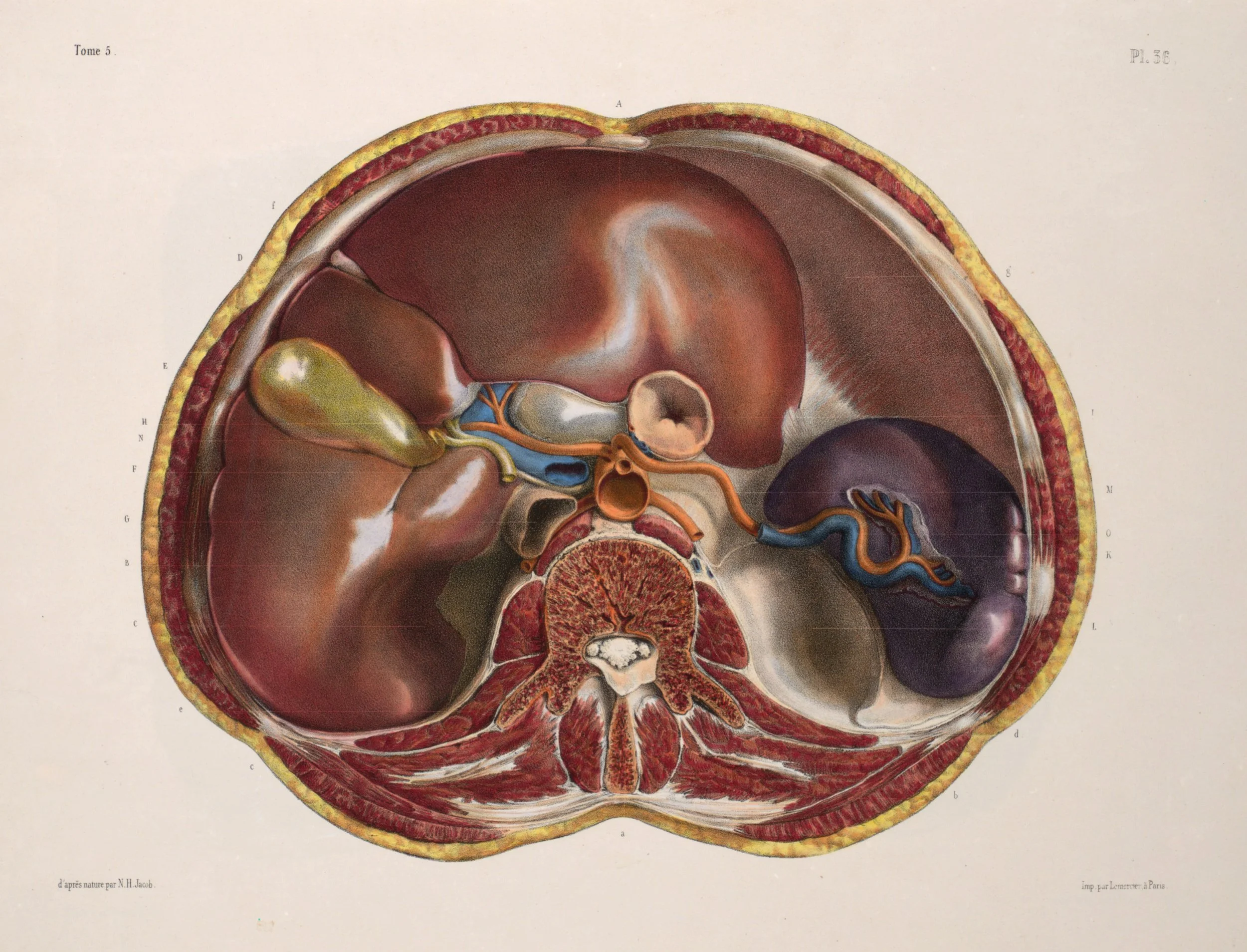 Biliary — Ultra Sono