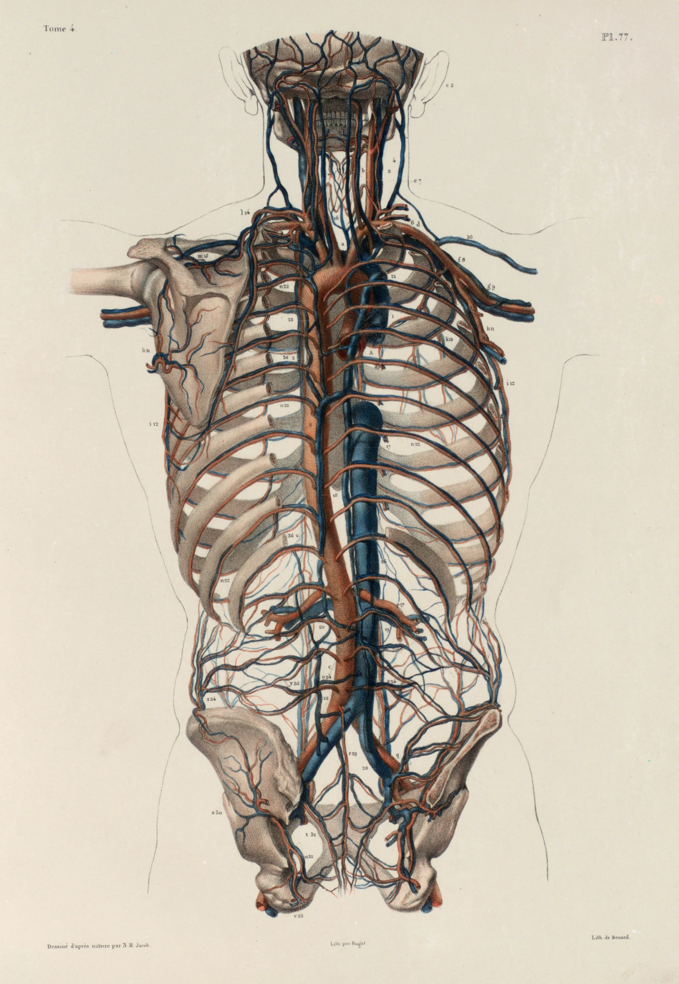 Aorta — Ultra Sono