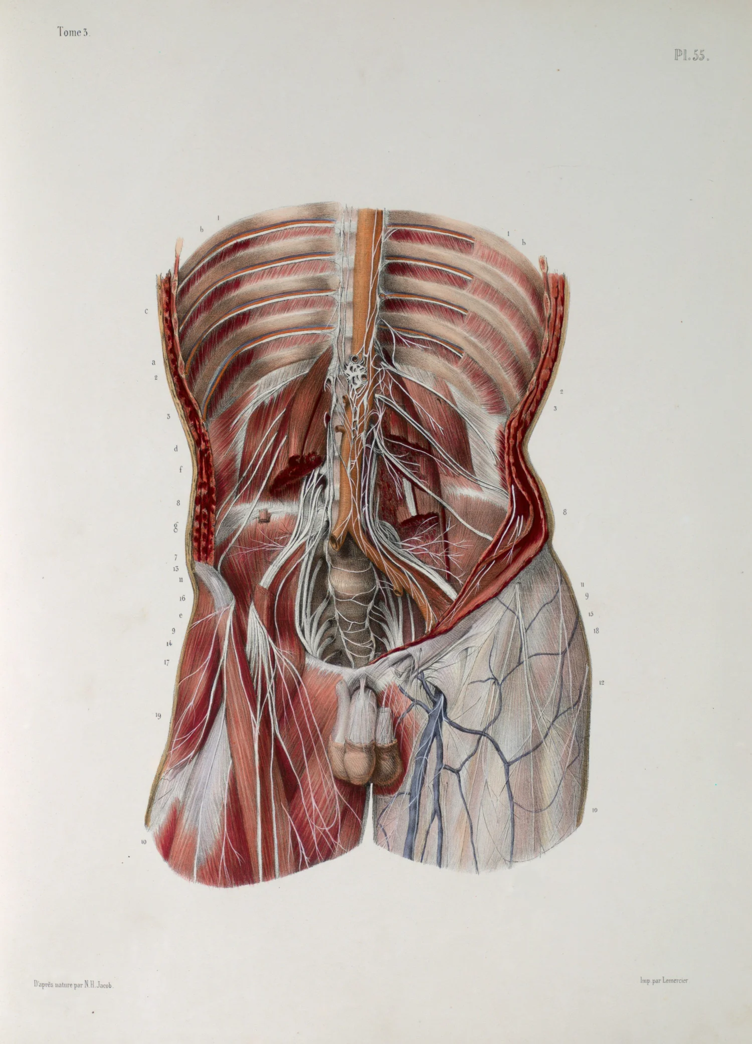 Blocks: Fascia Iliaca — Ultra Sono