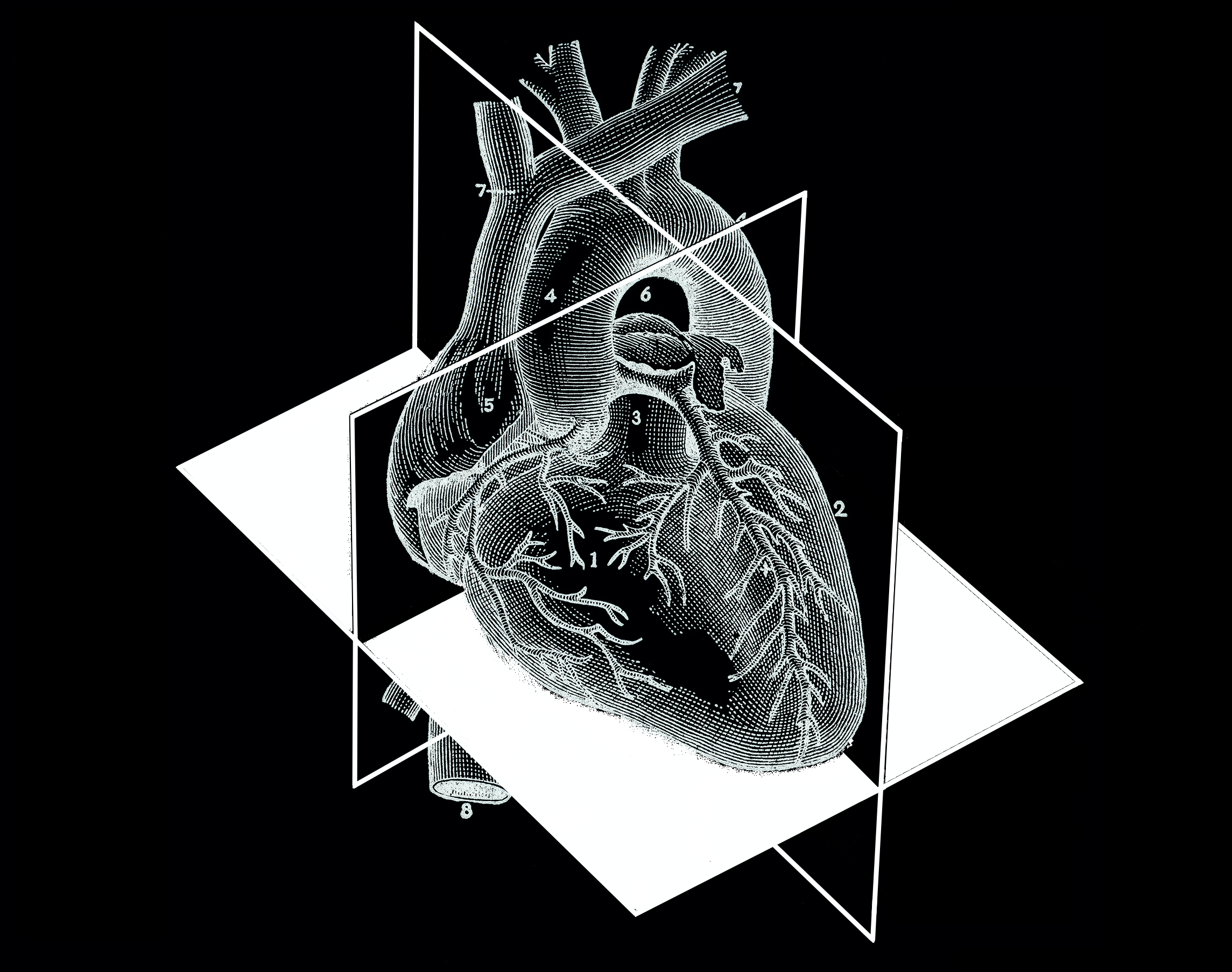 Heart: Basics — Ultra Sono