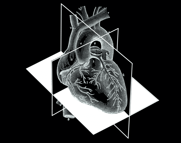 Heart: Basics — Ultra Sono