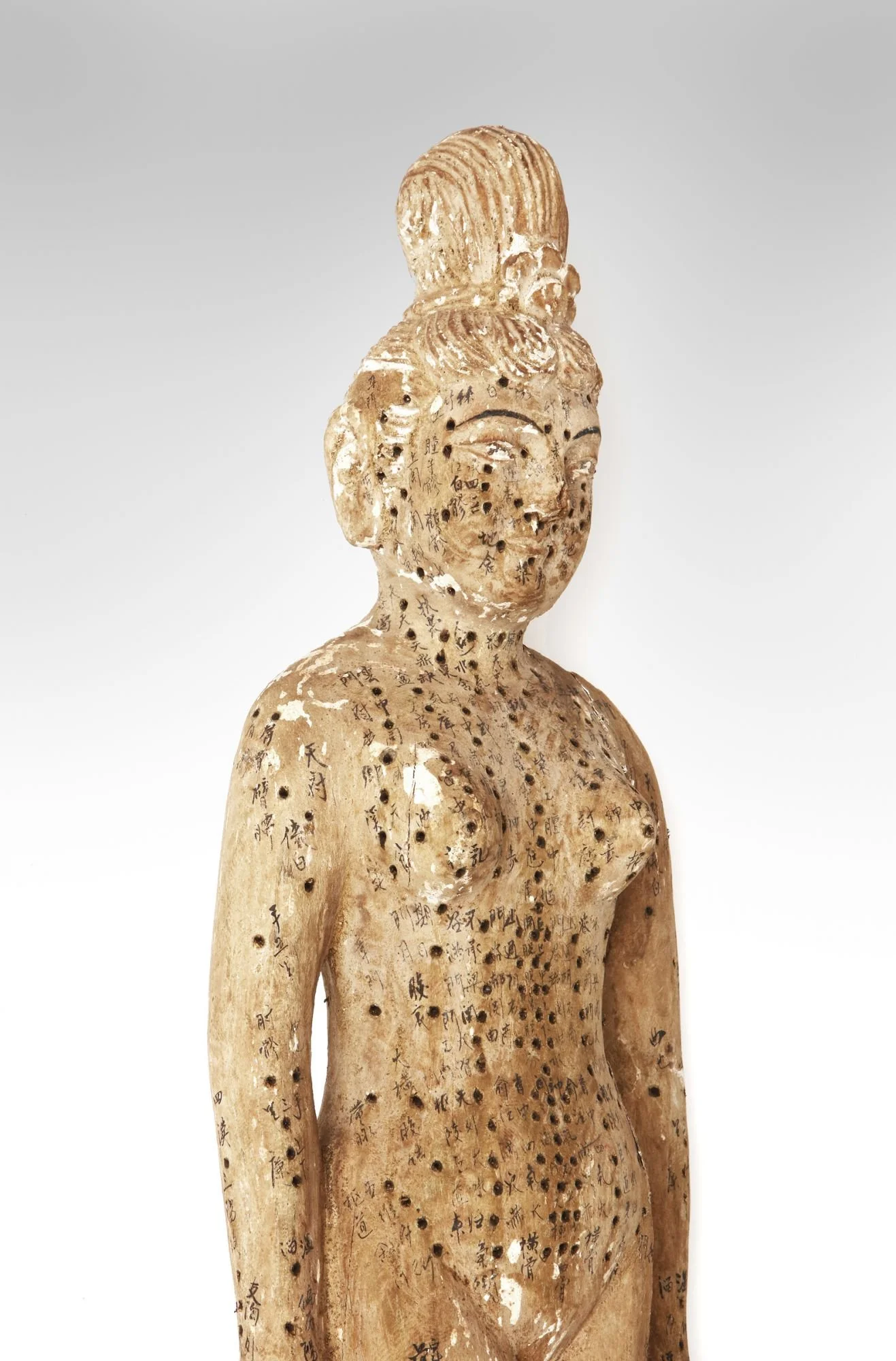 What is Acupuncture and can it help me - Acupuncturist Hertfordshire