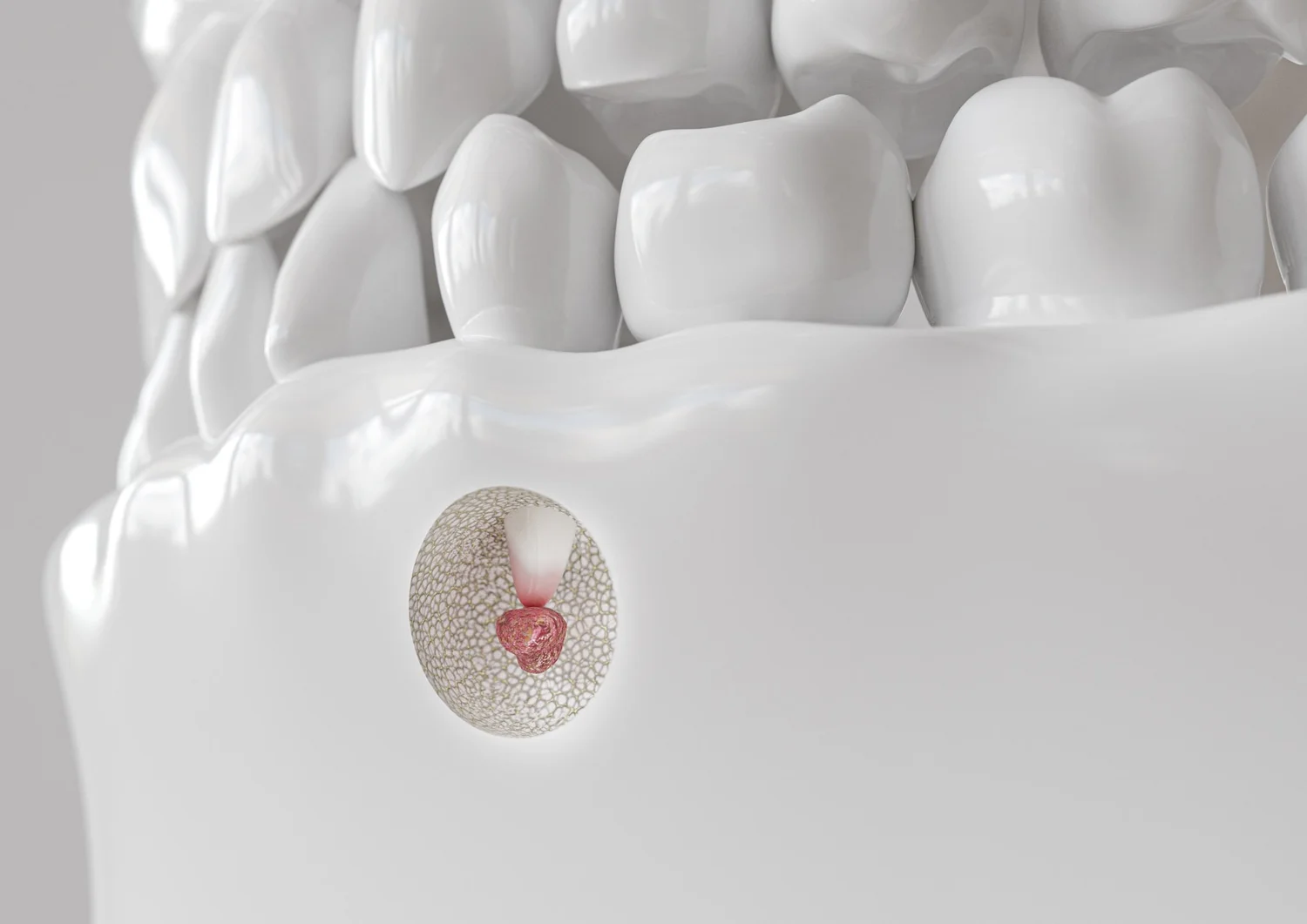 Apicoectomy (reverse root canal) — Elite Oral and Facial Surgery- Long ...