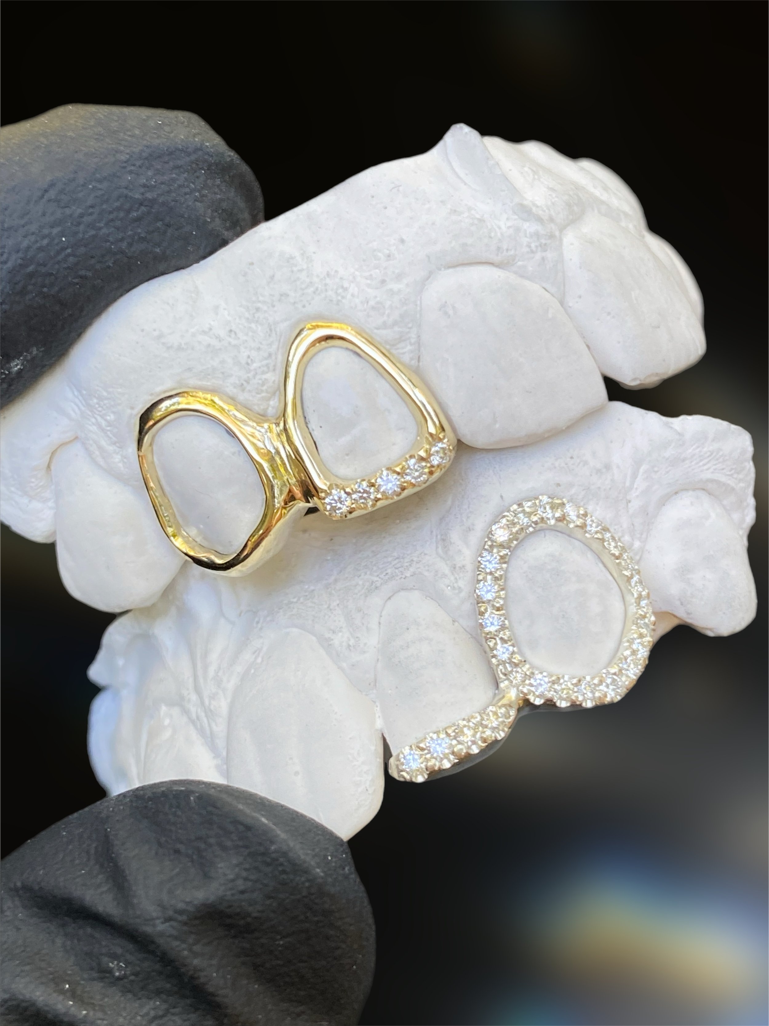 GRILLZ PRICE GUIDE — GRILLZ QUEEN