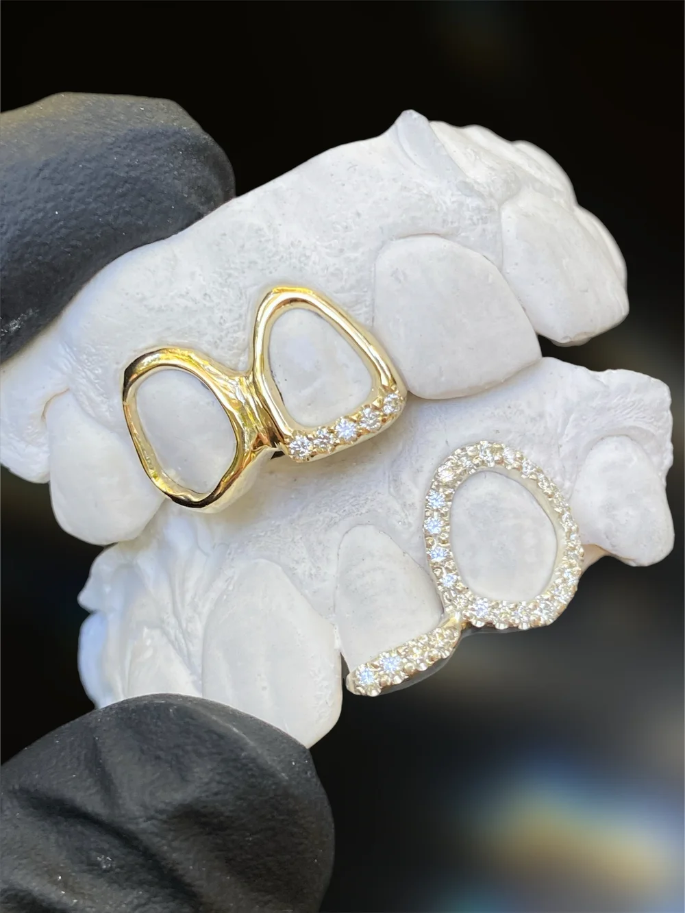 GRILLZ PRICE GUIDE — GRILLZ QUEEN