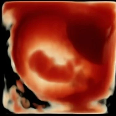 Tiny Blessings 4D Ultrasound Midtown