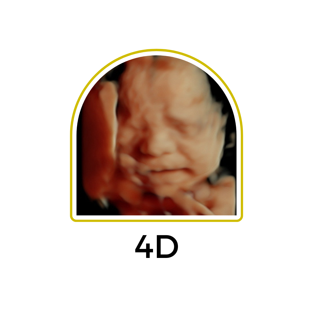 Tiny Blessings 4D Ultrasound Midtown