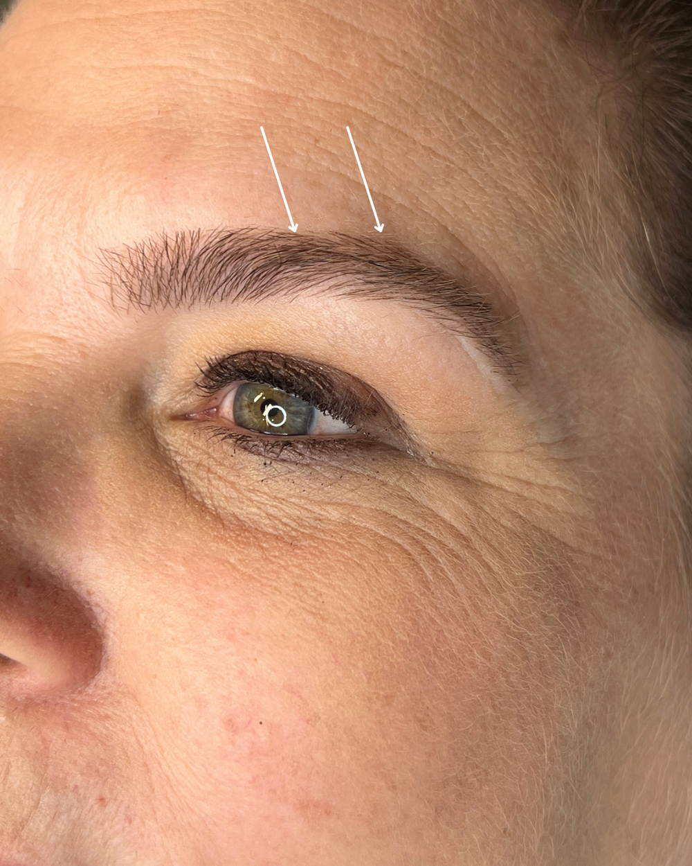 Thinning eyebrows and hairs? this might be the cause... — Your Eyes ...