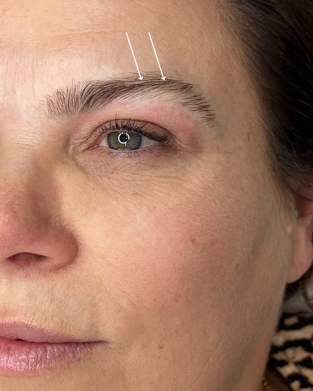 Thinning eyebrows and hairs? this might be the cause... — Your Eyes ...