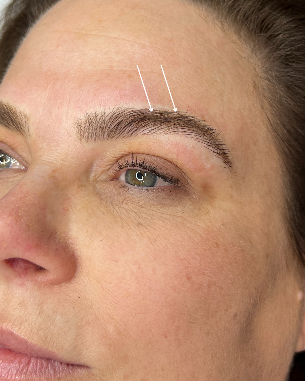 Thinning eyebrows and hairs? this might be the cause... — Your Eyes ...