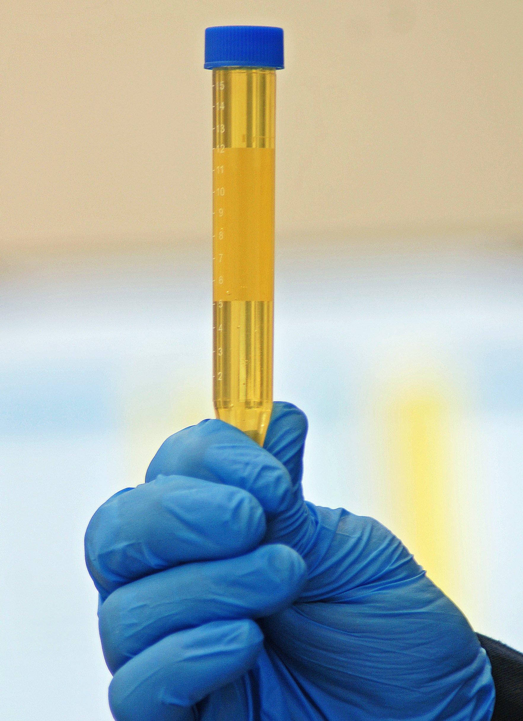 Organic CBD and CBG Extract, Distillate, Isolate and Biomass ...