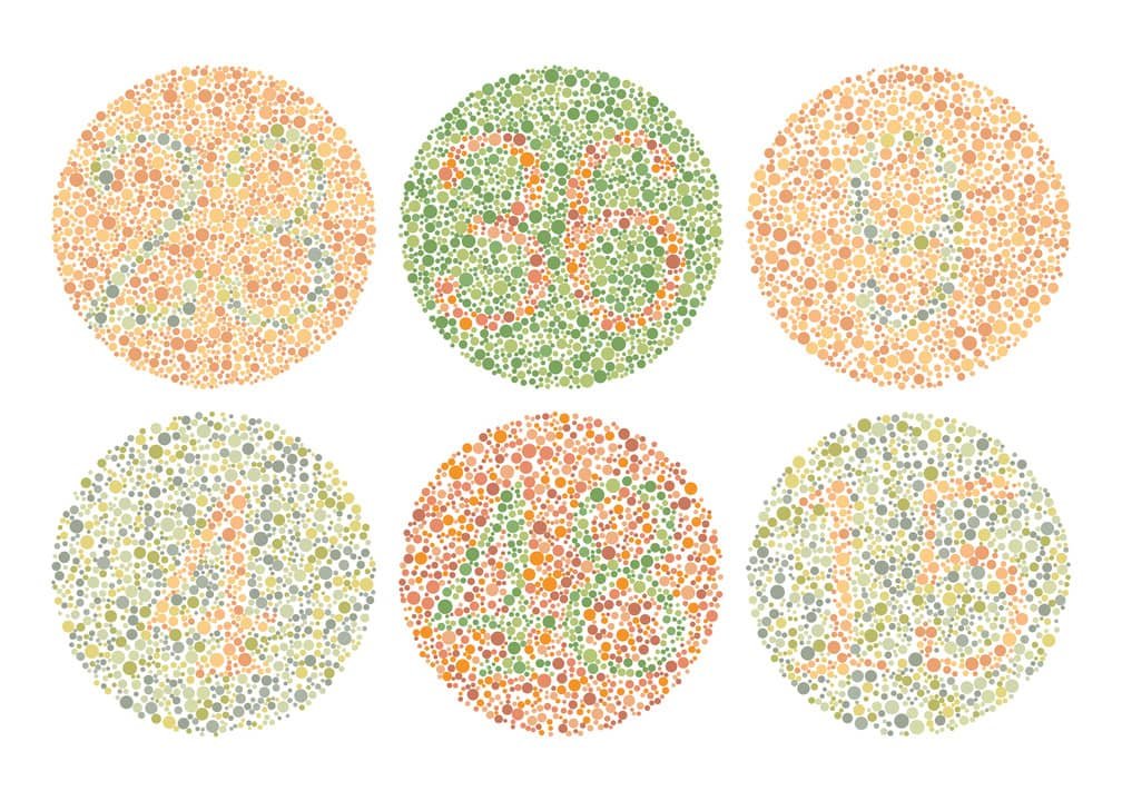 Colour Vision Testing: What It is and Its Importance