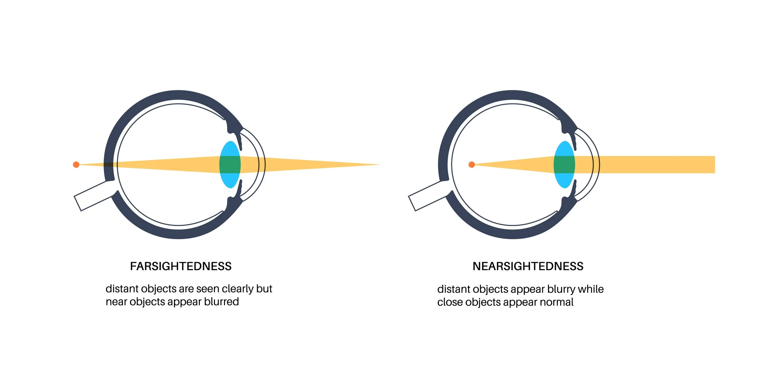 Definition of Short Sighted and Long Sighted [Key Differences]