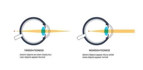 Definition of Short Sighted and Long Sighted [Key Differences]